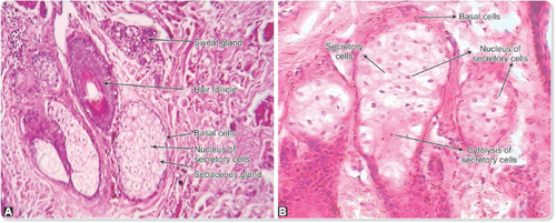 Sebaceous Glands Histology Slide