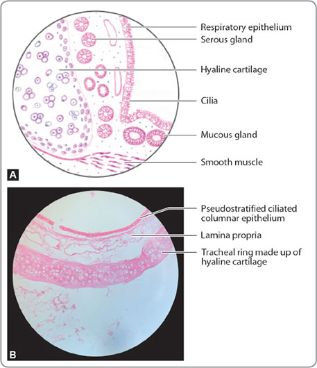 Trachea Histology Labeled Seromucous Glands