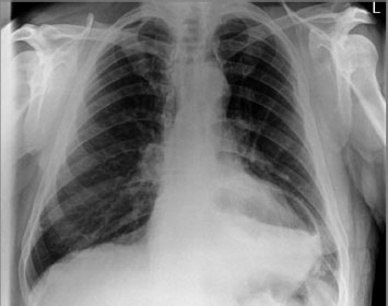 JaypeeDigital | eBook Reader