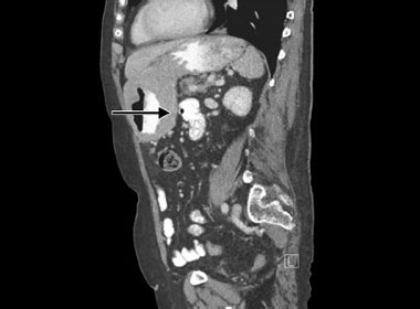 JaypeeDigital | eBook Reader