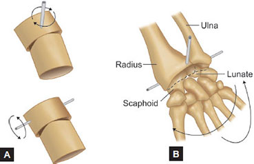 Saddle Joint Examples
