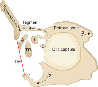 Otic Capsule Anatomy The Origin Of The Stapes And Relationship To The