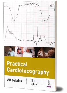JaypeeDigital | Cardiotocography and Fetal Acidosis