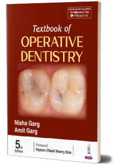 JaypeeDigital | Interim Restorations