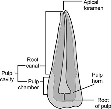 Pulp Horn