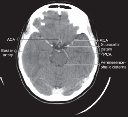 JaypeeDigital | eBook Reader