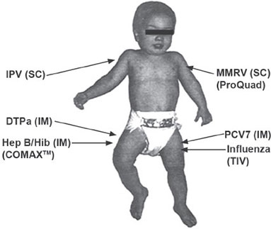 Subcutaneous Injection Sites For Infants