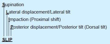 Kocher Maneuver Mnemonic