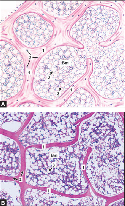 Trabecular Bone Histology Diagram
