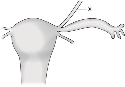 Posterior Fourchette Anatomy