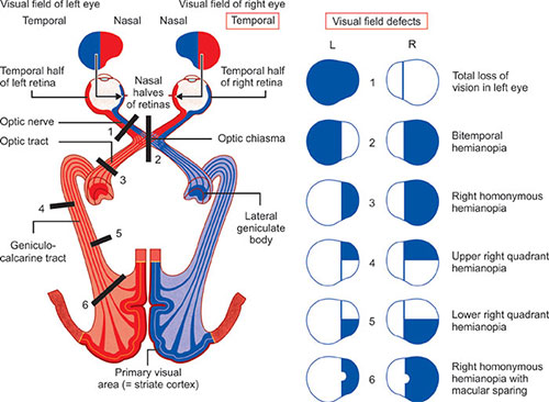 Quadrantenanopsie Icd