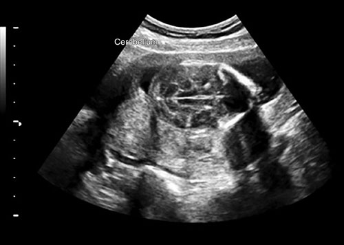 JaypeeDigital | eBook Reader