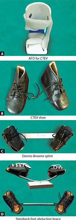 Denis Browne Splint JRCO DENIS BROWNE SPLINT