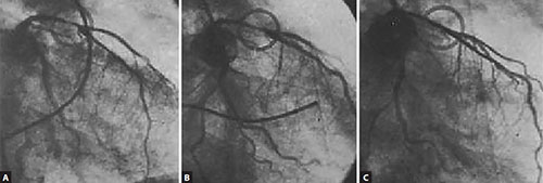 JaypeeDigital | eBook Reader