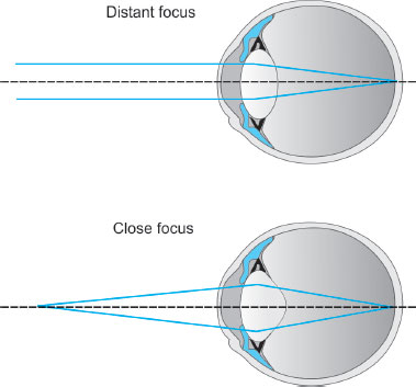 Light Refraction In Eye