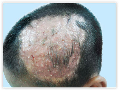 JaypeeDigital | eBook Reader