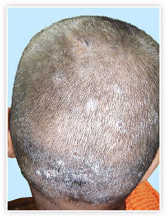 JaypeeDigital | eBook Reader