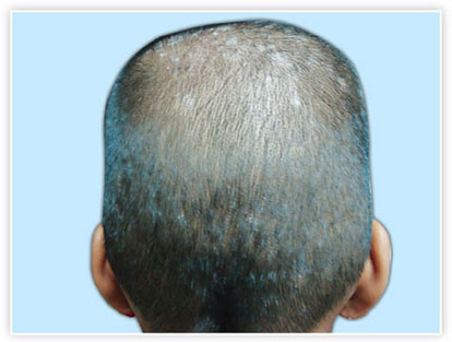 JaypeeDigital | eBook Reader