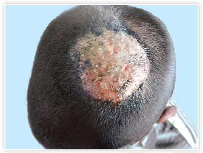 JaypeeDigital | eBook Reader