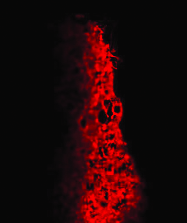 Evaluation of Penetration Depth and Caries Progression using Resin ...