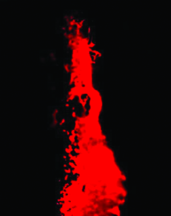 Evaluation of Penetration Depth and Caries Progression using Resin ...