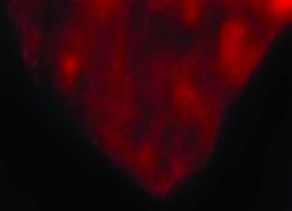 Evaluation of Penetration Depth and Caries Progression using Resin ...