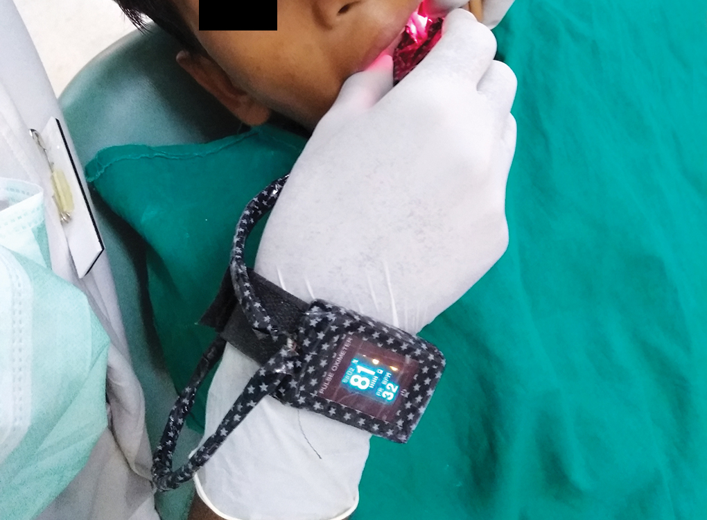 Evaluation of Oxygen Saturation Levels Using a Custom-modified Finger ...