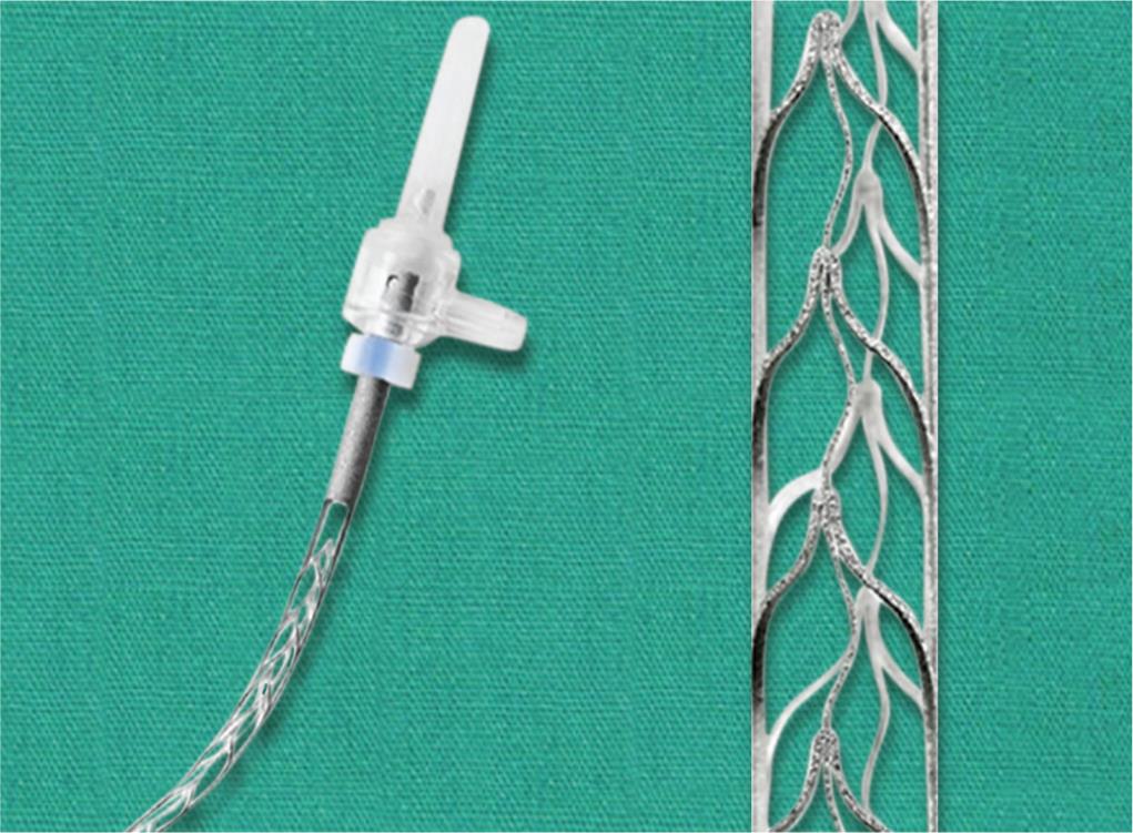 Comparative Analysis of Dentinal Crack Formation Following Root Canal ...