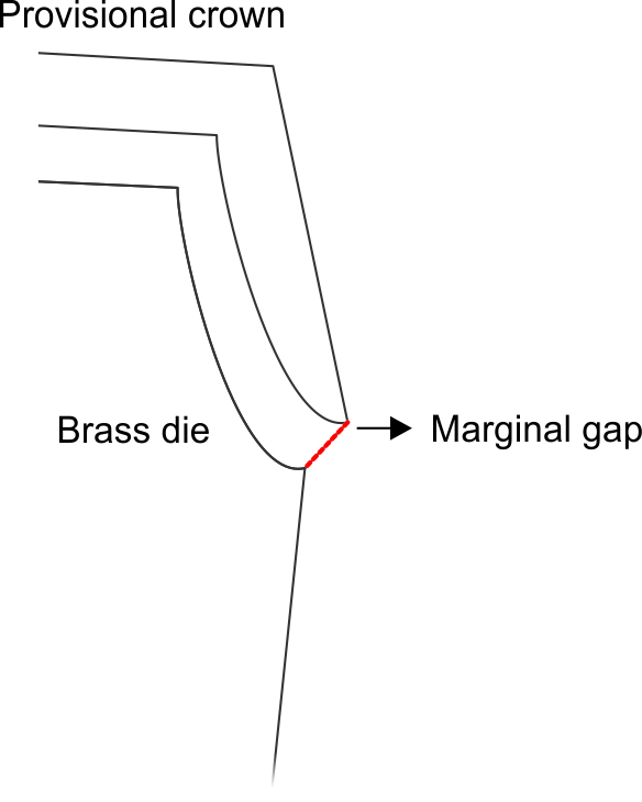 Assessment of Marginal and Internal Adaptation in Provisional Crowns ...