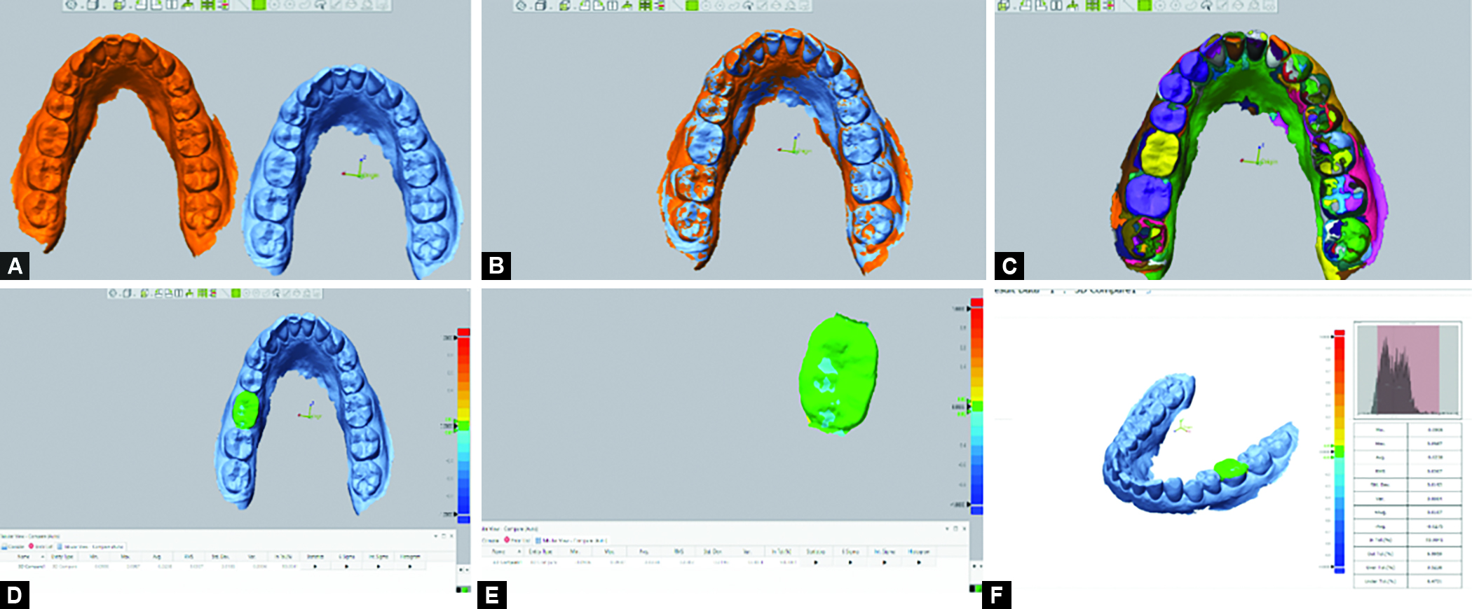 Wear of Enamel Antagonist to Polished vs Glazed Zirconia-reinforced ...