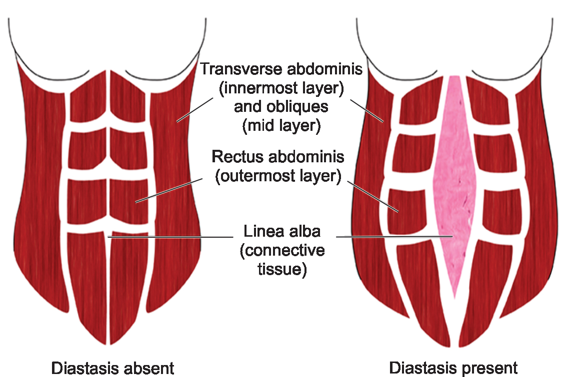 What Is A Single Case Study Design - Design Talk